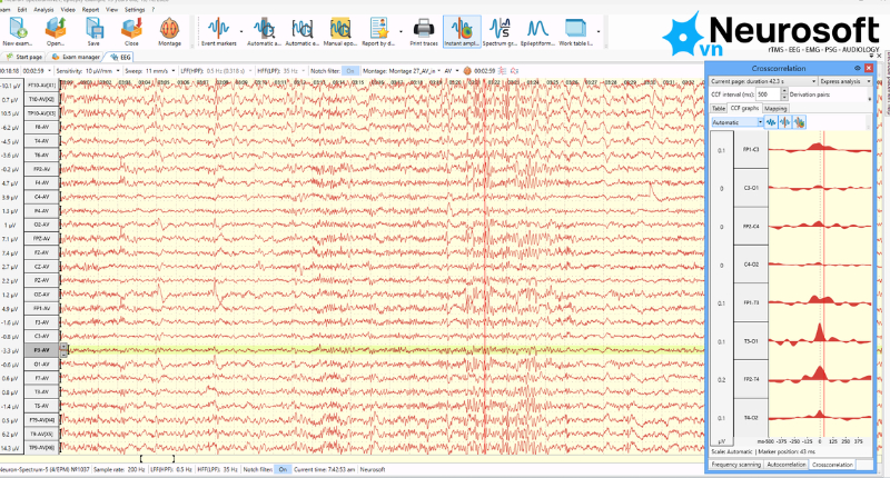 Máy đo điện não 11/19/21/25/39 kênh - brainwavesolutions